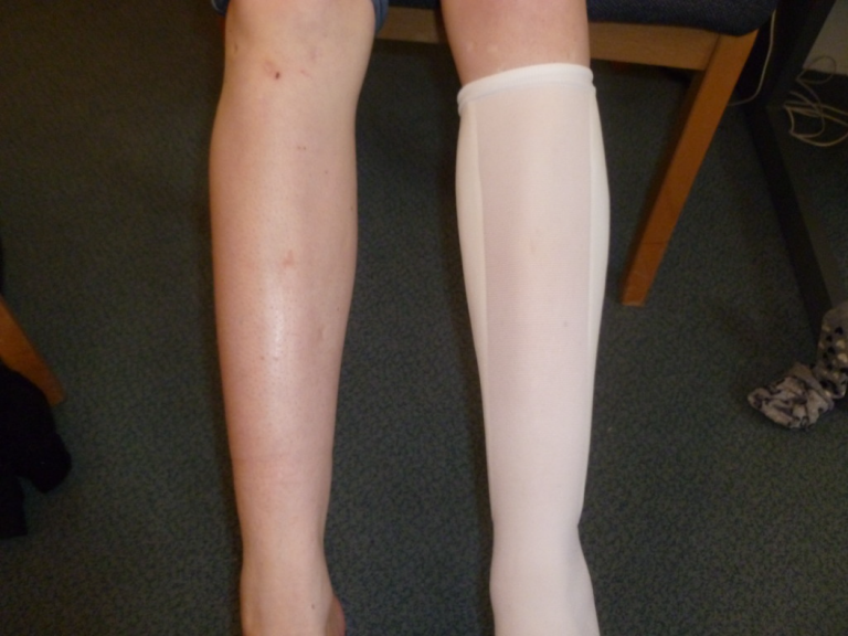 Homepage - Premier Orthotics